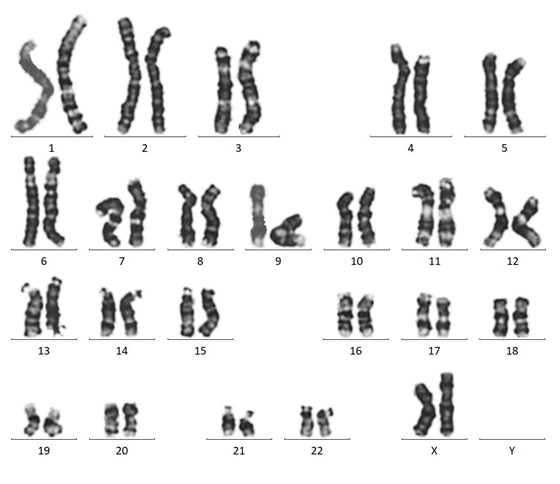 FDIBSi001-A · Cell Line · hPSCreg